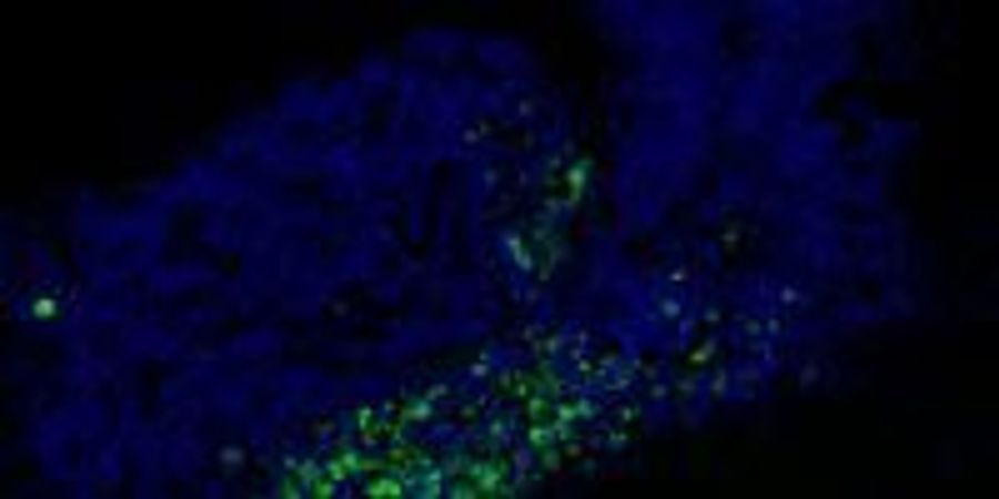 Brain Guardians Remove Dying Neurons | Lab Manager