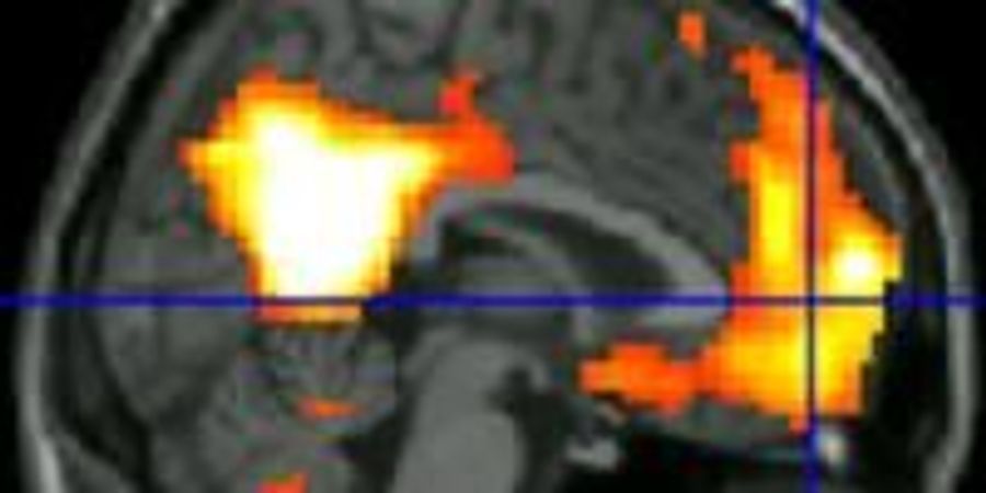 Brain Changes Seen in Veterans with PTSD after Mindfulness Training ...