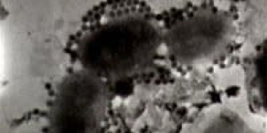 Study Shows Large Variability in Abundance of Viruses that Infect Ocean ...