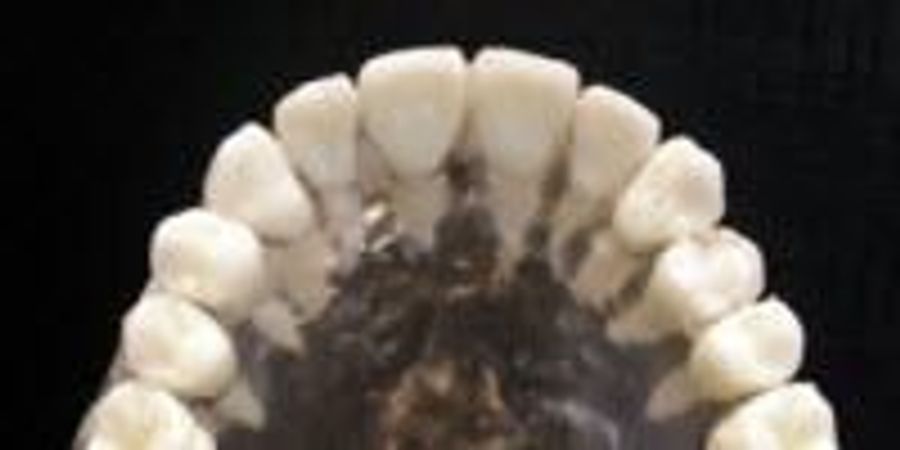 Landmark Research Shows Bite-Mark Analysis Can Lead to False ...