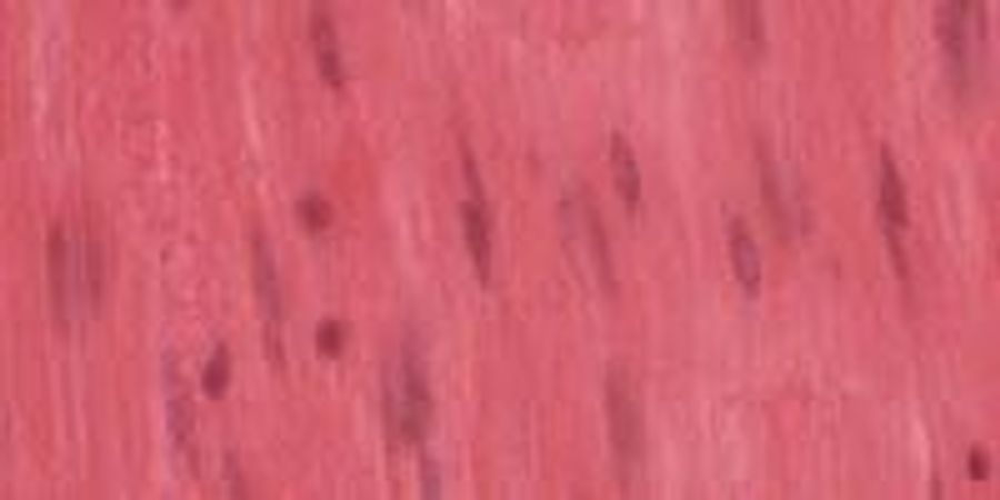 Scientists Identify a Critical Pathway to Improve Muscle Repair | Lab ...