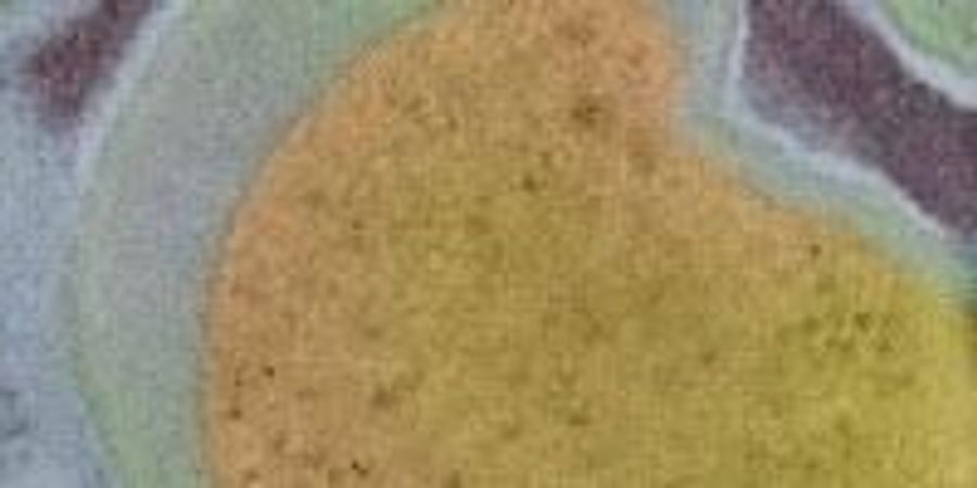 Super-Quiet Lab Area Helps Advance Understanding of Biological and ...