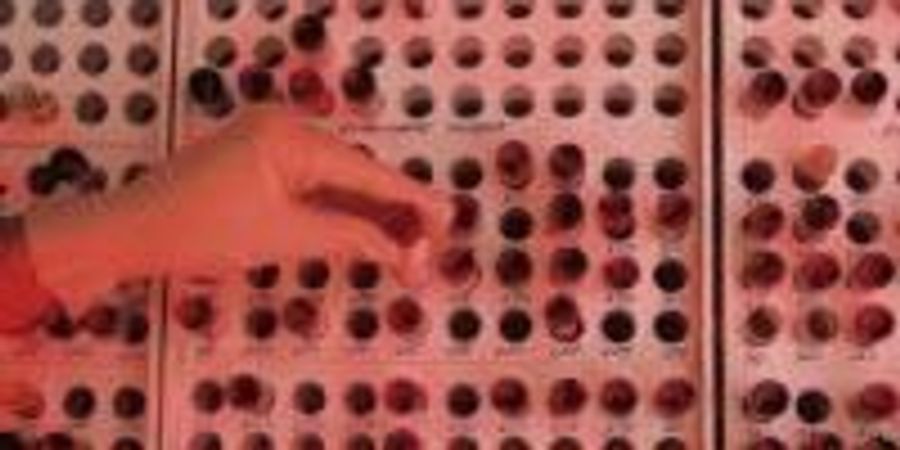 Cancer Research Plagued by Poor Study Design | Lab Manager