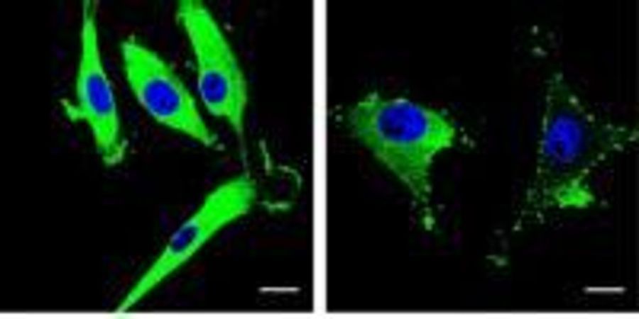 Team Develops New Tagging Technique for Better Cancer Detection | Lab ...