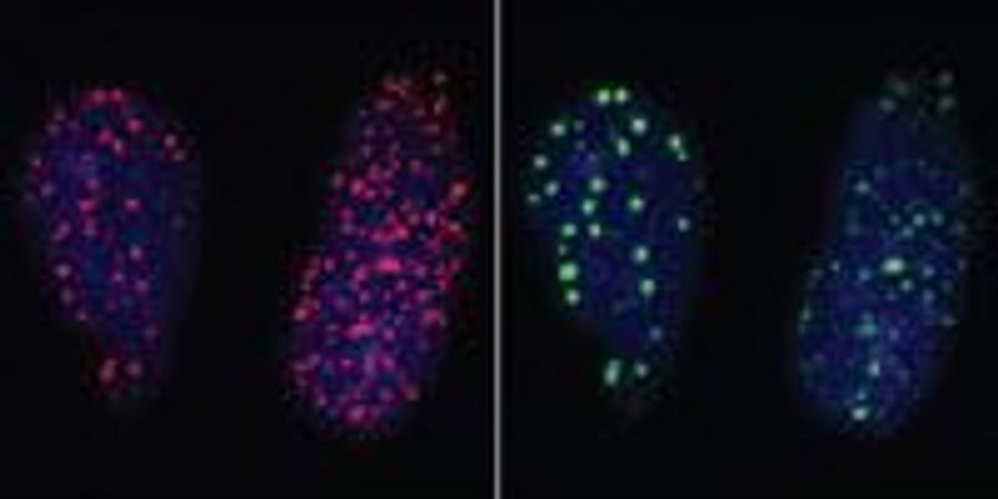 New Findings Shed Light on Fundamental Process of DNA Repair | Lab Manager