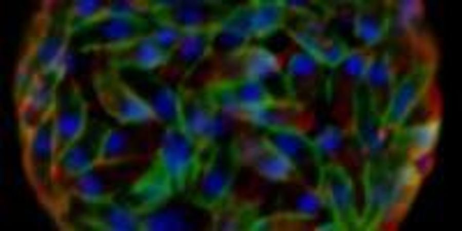 “Dormant” Parasite Cysts Found to be Quite Active | Lab Manager