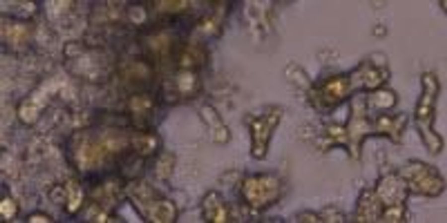 Next-Gen Genomic Tests Identify Brain-Eating Amoeba | Lab Manager