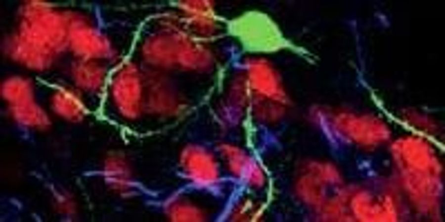 Testing Sound Waves as Radiation-Free Medical Treatment | Lab Manager