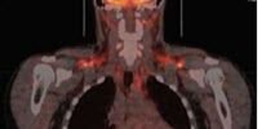 Scientists Discover Why Brown Fat Is Good for People's Health | Lab Manager