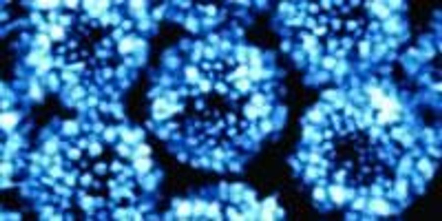 Researchers Develop Way of Making Light-bending ‘Raspberry-like ...