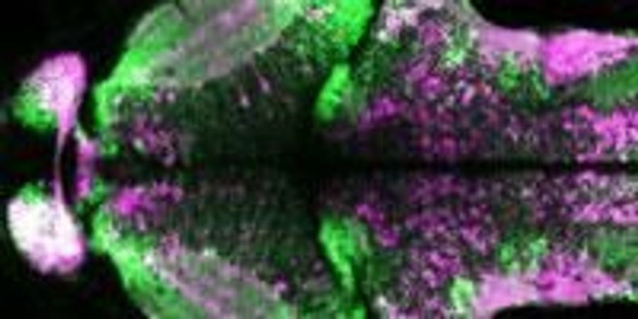 New Fluorescent Protein Permanently Marks Neurons that Fire | Lab Manager