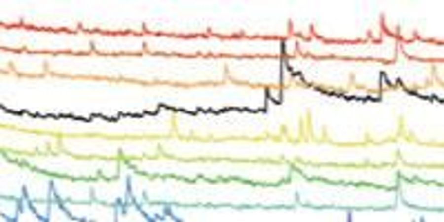 New High-Speed 3D Microscope—Scape—Gives Deeper View of Living Things ...