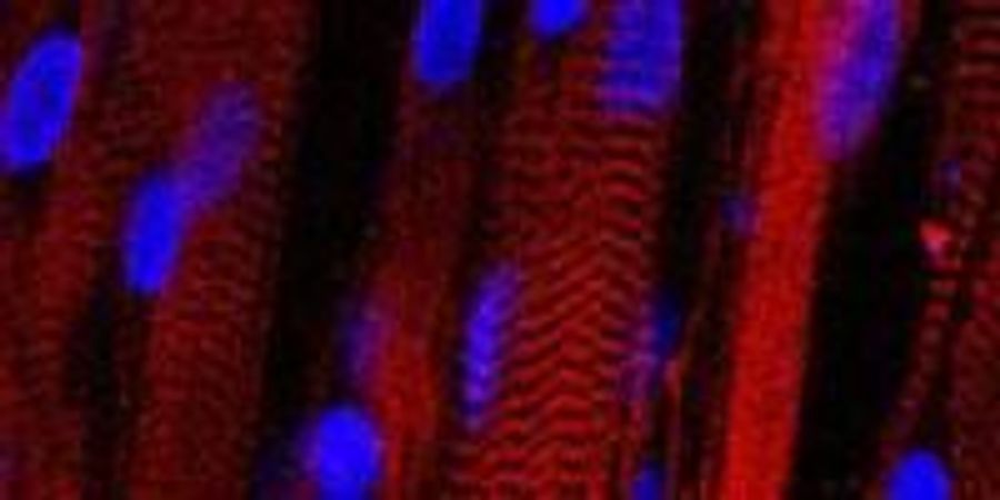 First Contracting Human Muscle Grown in Laboratory | Lab Manager