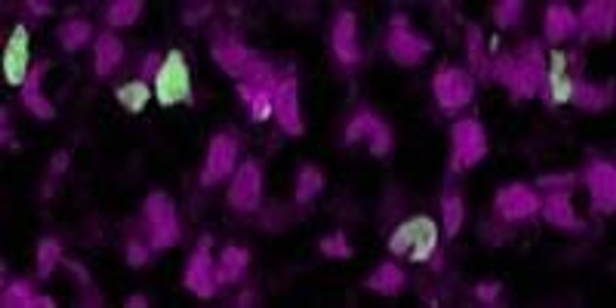 Scientists Create Precursors to Human Egg and Sperm | Lab Manager