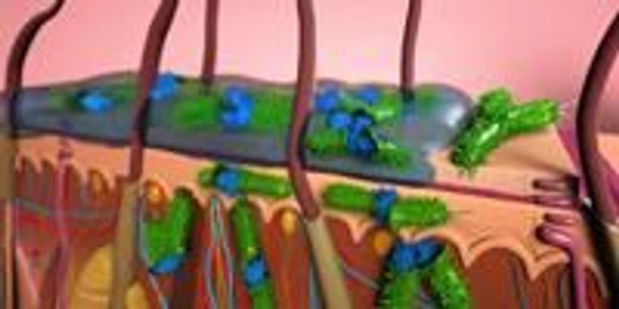 Breakthrough Antibacterial Approach Could Resolve Serious Skin ...