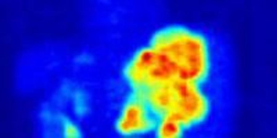 Computer Model Reveals Cancer's Energy Source | Lab Manager