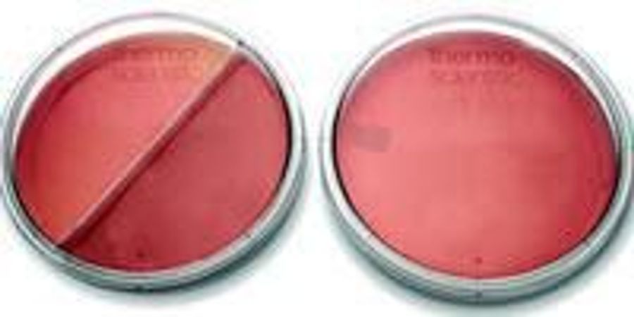 Automation-Compatible Prepared Culture Media Plate Technology Boosts ...