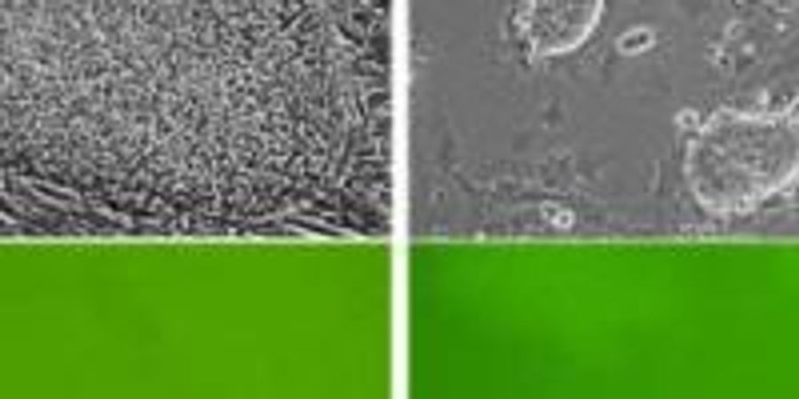 Researchers Create 'Naive' Pluripotent Human Embryonic Stem Cells | Lab ...