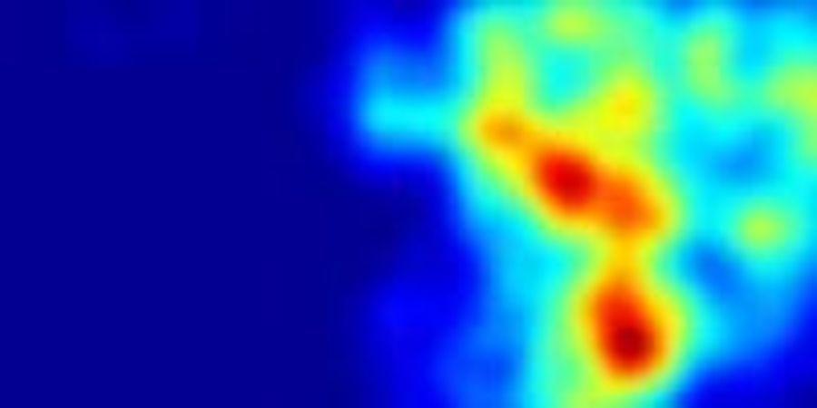 To Recover Consciousness, Brain Activity Passes Through Newly Detected ...