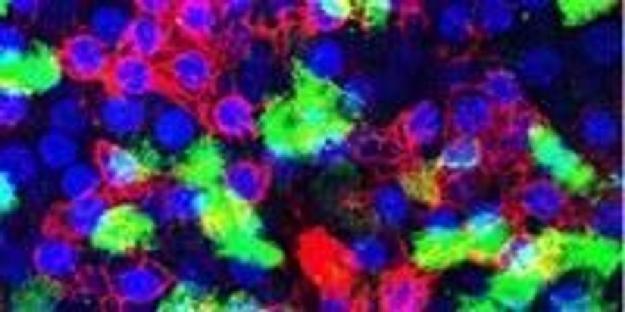 Lung Cell Patches Its Own DNA on the Fly to Survive Influenza | Lab Manager