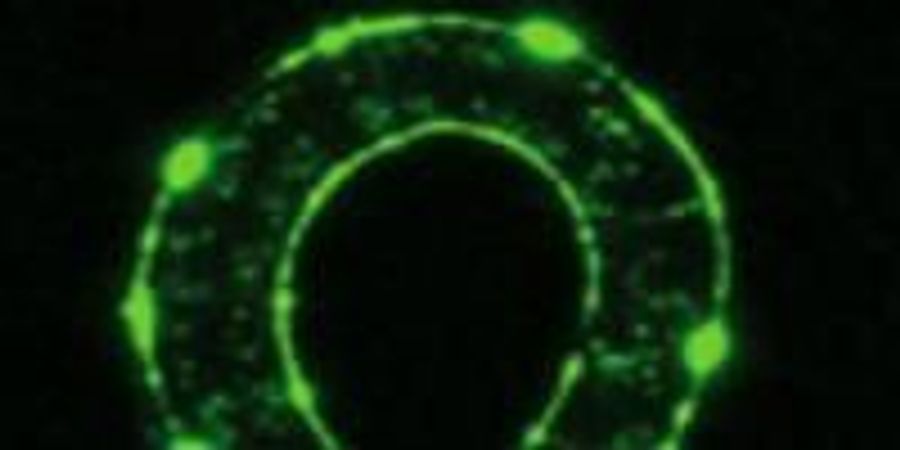 Mechanism of Forgetting Discovered | Lab Manager