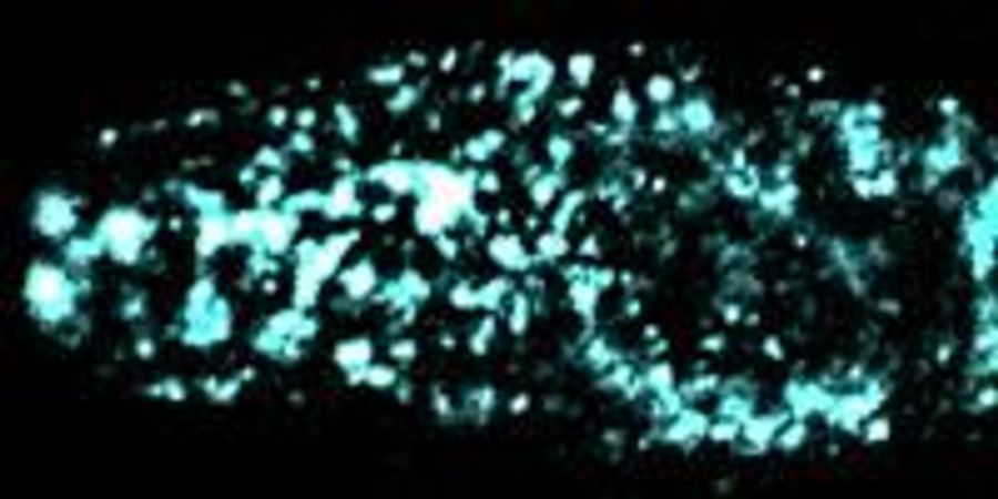 The Hubbub About the Heart’s Lub-Dub | Lab Manager