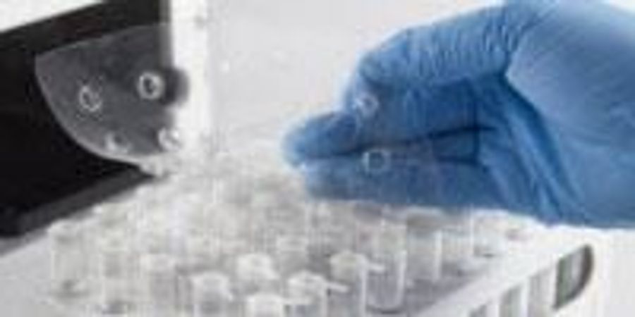 Short Term Storage of Blood or Urine Samples | Lab Manager