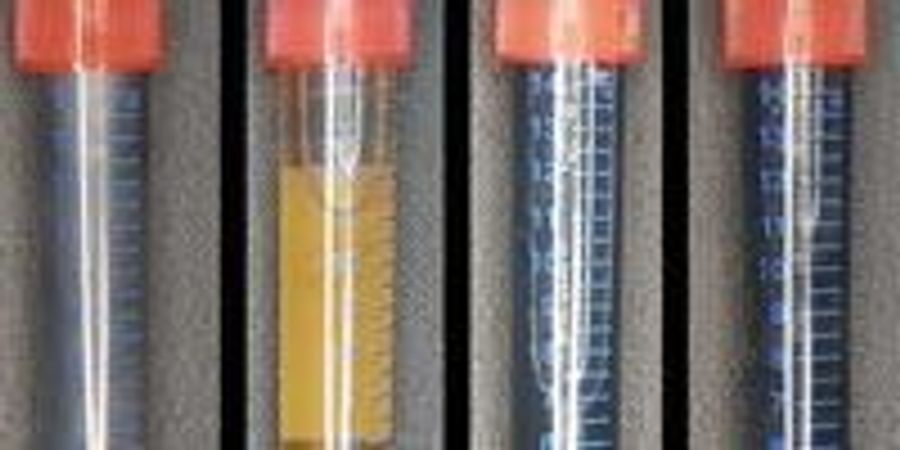 Will Your Future Computer Be Made Using Bacteria? | Lab Manager