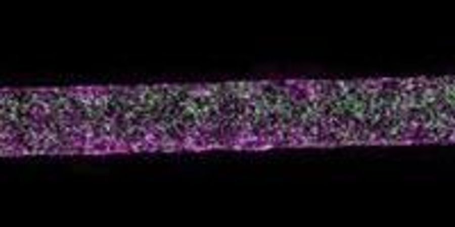 First Blood-Brain Barrier Chip Using Stem Cells Developed | Lab Manager