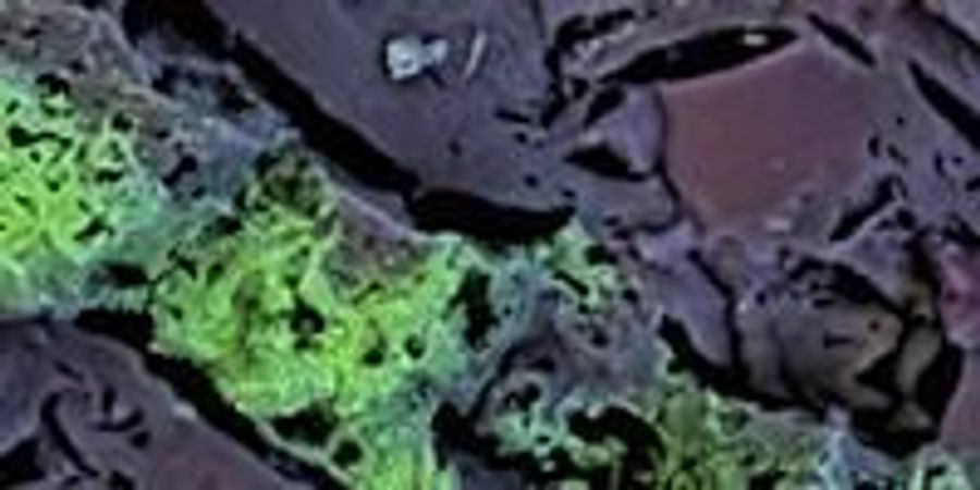 New Solution for Scanning Electron Microscopes Includes Immediately ...