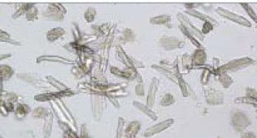 Endotoxin-Free Water for Tissue Culture | Lab Manager