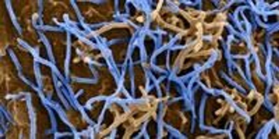 Newly Discovered Ebolavirus May Not Cause Severe Disease in Humans ...