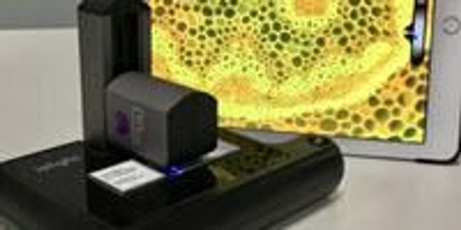 ioLight Launches Its Compact and Portable Fluorescence Microscope | Lab ...