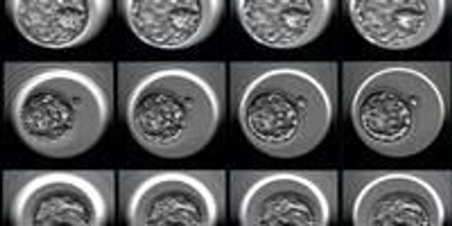 Artificial Intelligence Approach Optimizes Embryo Selection For Ivf Lab Manager