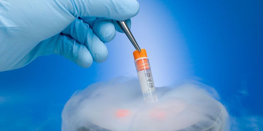 Are You Storing Your Cells Properly? | Lab Manager