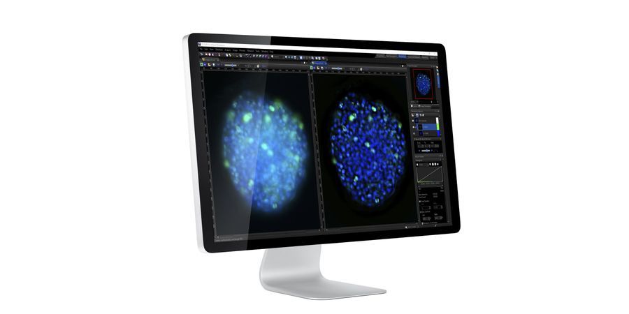 Next-Generation Microscopy Image Analysis with Deep-Learning Technology ...