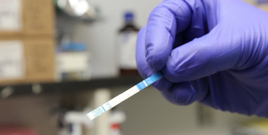 Research Collaboration Assesses Fentanyl Screening Test | Lab Manager