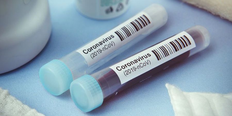 Accumen Launches Comprehensive COVID-19 Lab Resource Center | Lab Manager