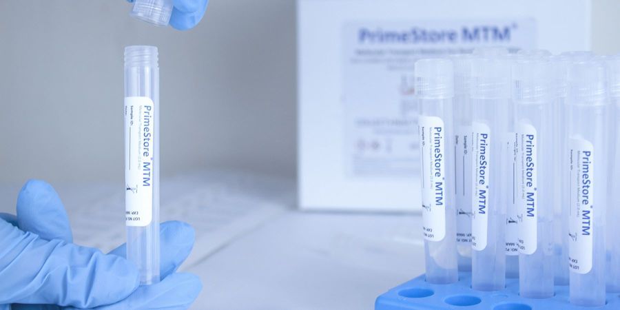 EKF Secures COVID-19 Novel Sample Collection Kit Manufacturing and ...