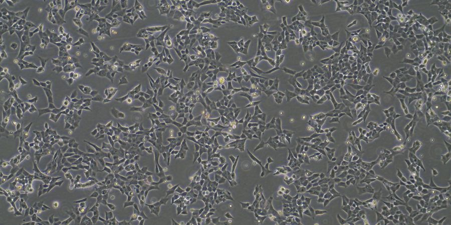 Cas9 and dCas9-VPR Stable Cell Lines to Simplify and Accelerate CRISPR ...