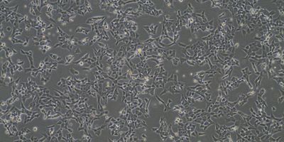 Cas9 and dCas9-VPR Stable Cell Lines to Simplify and Accelerate CRISPR ...