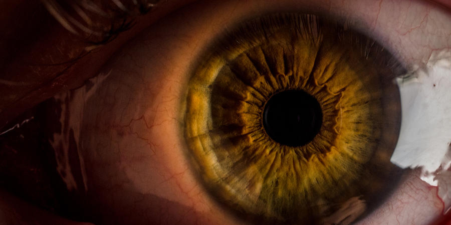 PTSD Eyes: The Connection Between Traumatic Experiences and Pupil ...