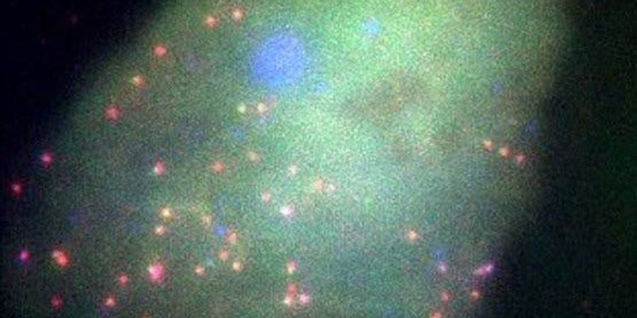 Biosensor Illuminates In Real Time How Viruses Attack Hosts Lab Manager