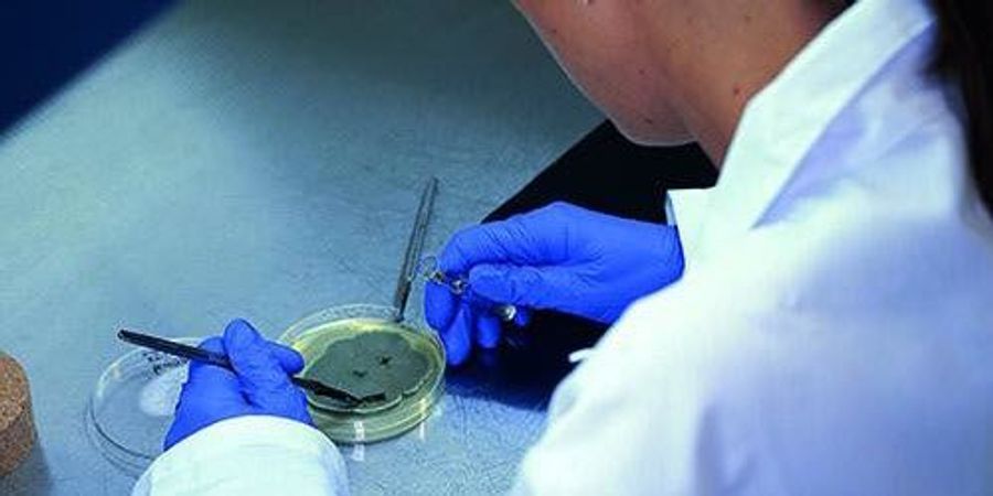 New Insights Could Mean More Natural and Safer Fungicides | Lab Manager