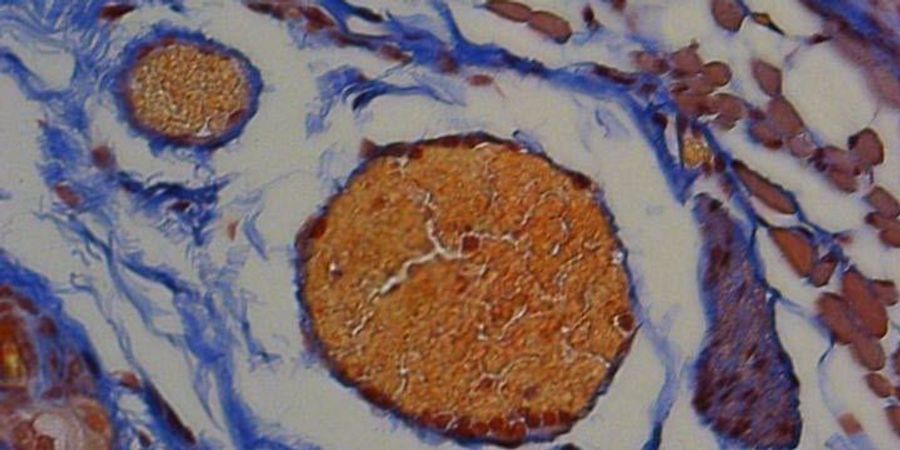 Using Light, Red Blood Cells, and a Honey Bee Peptide to Deliver ...