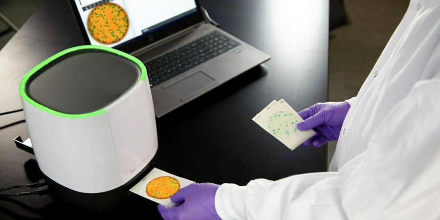 Faster Automated Plate Enumerations | Lab Manager