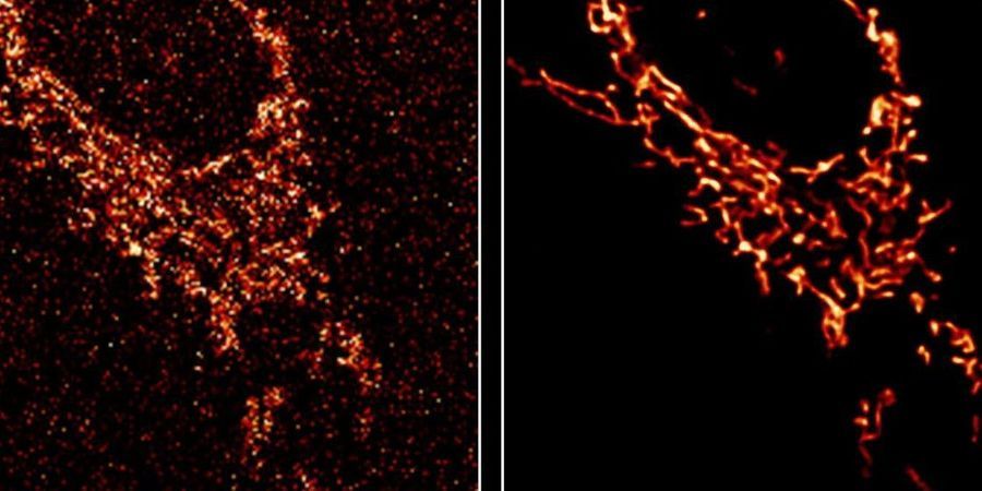 How AI Is Revolutionizing Microscope Image Quality: The Role of Deep ...