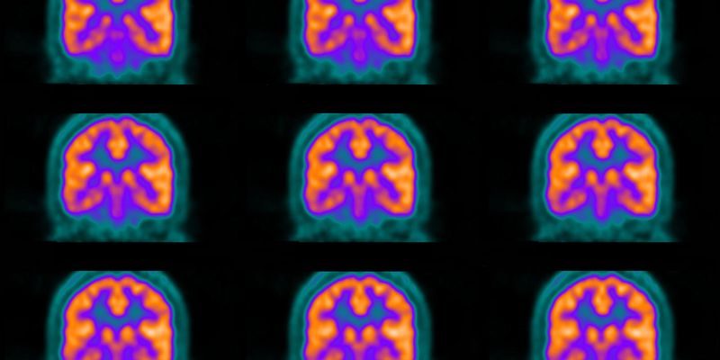 PET-Based Technique Aids Better Live Visualization | Lab Manager