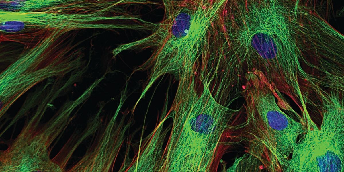 Confocal Imaging Laser Scanning Confocal Microscopy | Covalent