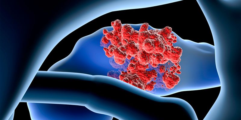 Scientists Discover Mechanism Controlling Spread of Pancreatic Cancer ...